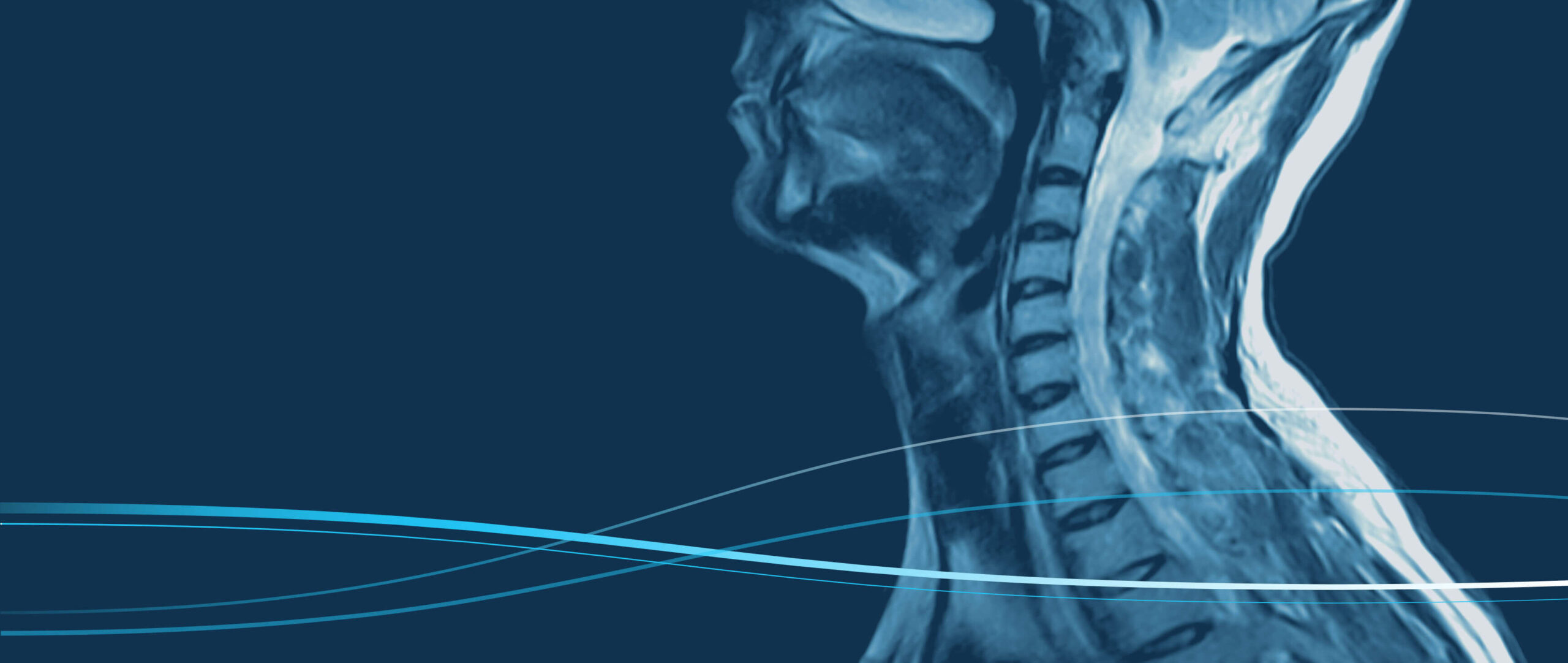 Gateway Diagnostic Imaging in Dallas Forth Worth • MRI • CT